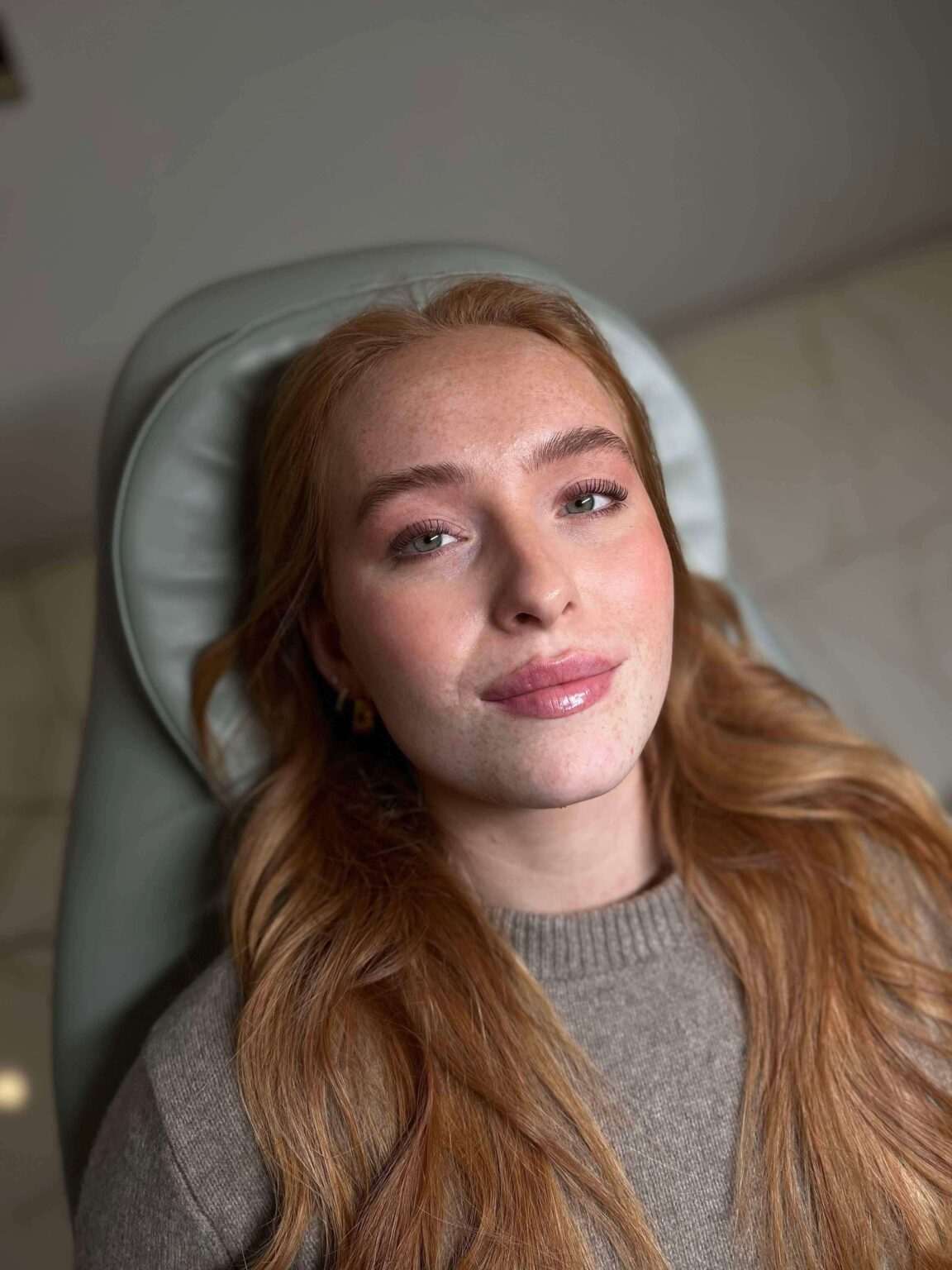 Filler | Udglat Rynker Og Fine Linjer | N'finity Beauty